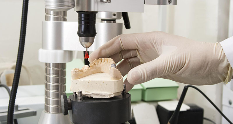 Prothèse conjointe Ajaccio - Laboratoire Luccioni Prothèse Dent'aire ...